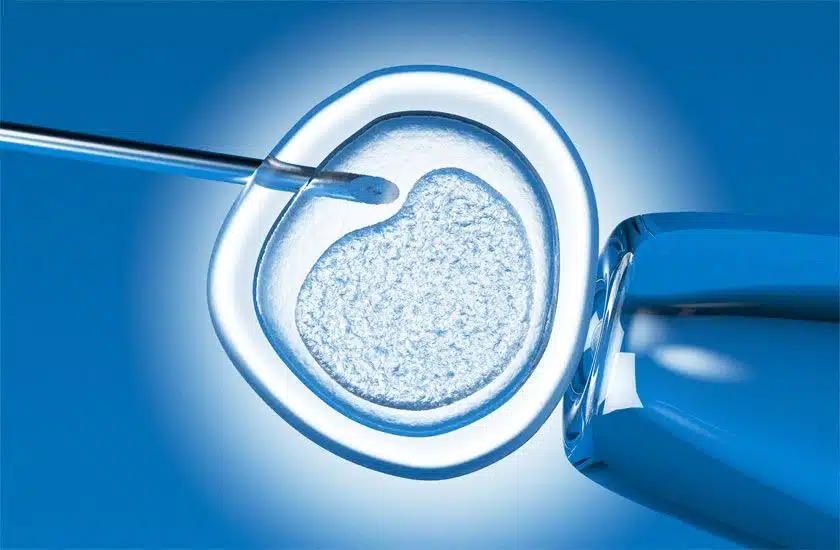 ICSI Services - Narjes Infertility Treatment Center